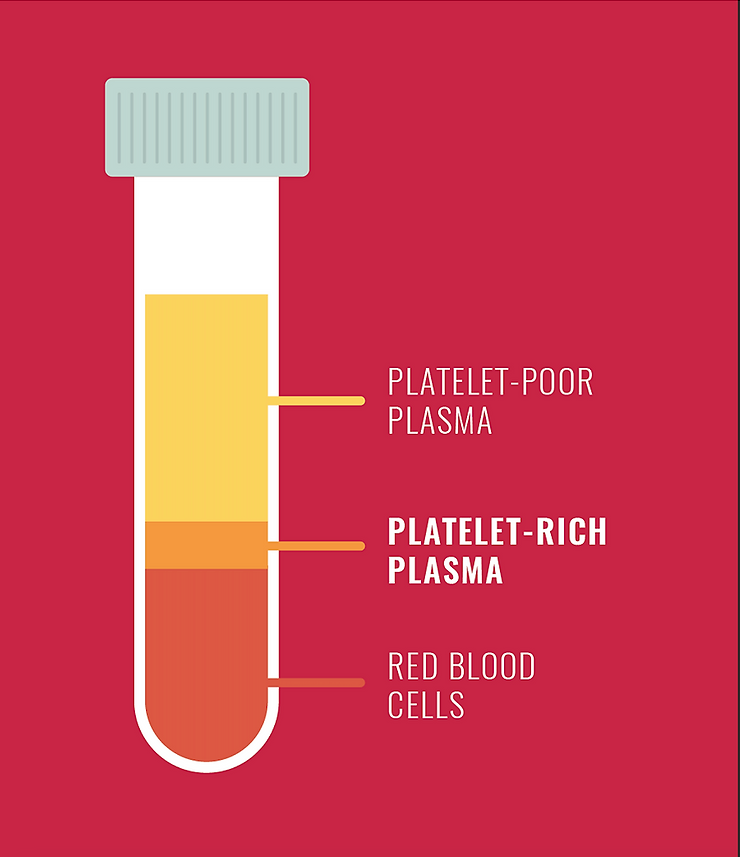 Why PRP Undereye Treatment Is A Worthwhile Choice